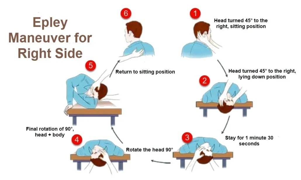 What Is the Epley Maneuver—And Can It Really Stop Vertigo ...